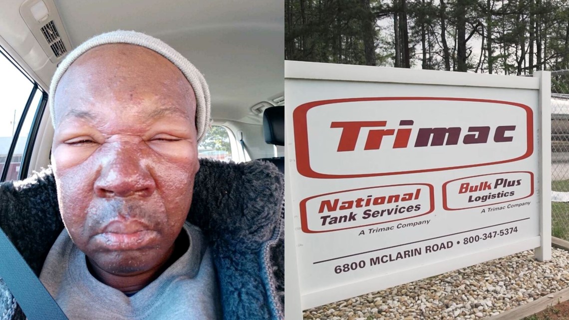 Trimac workers: Company exposed us to cancer-causing chemicals ...