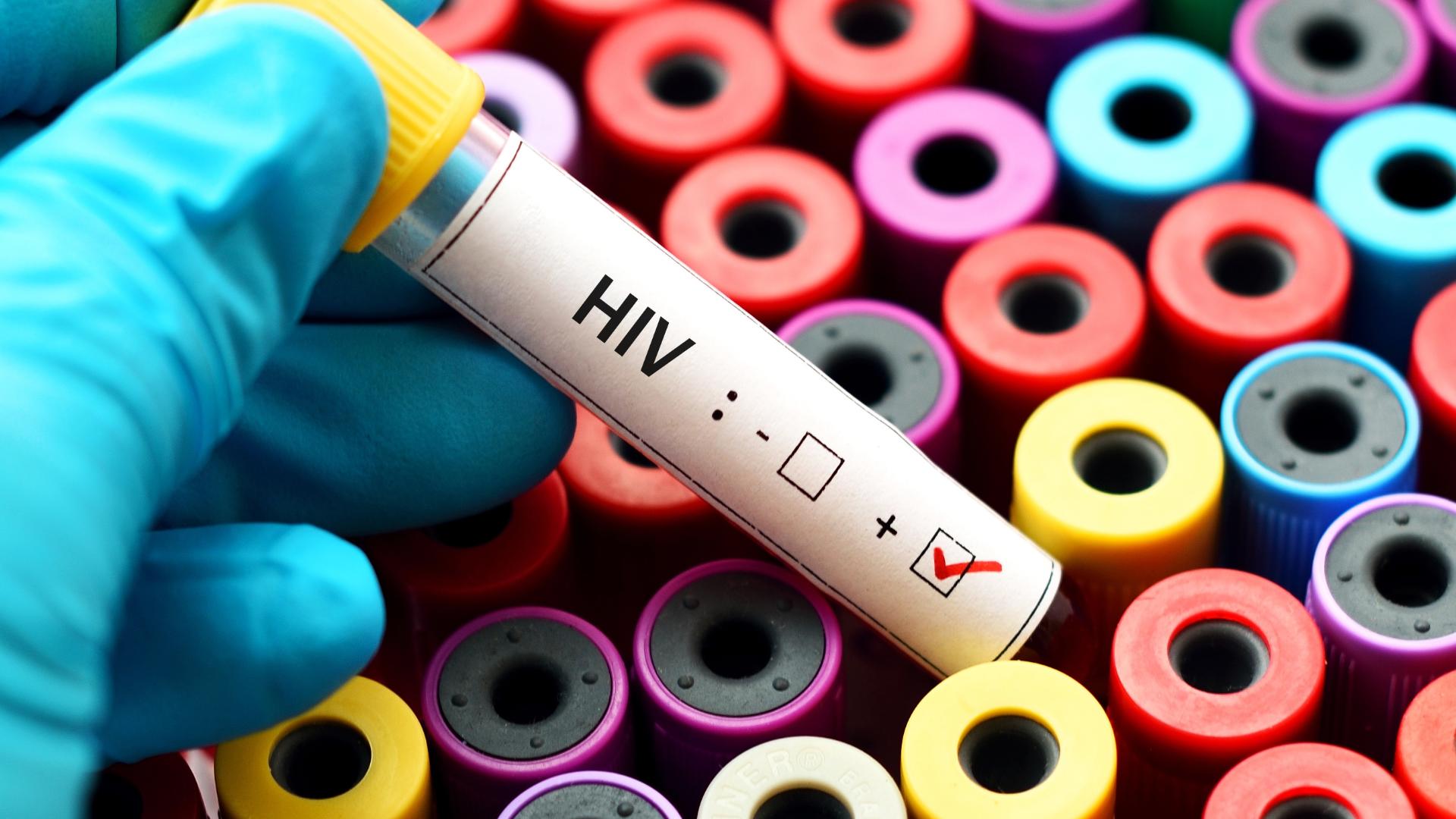 Fulton County receives $5 million grant to fight HIV | 11alive.com