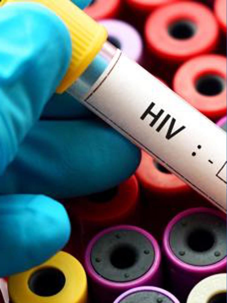 Fulton County receives $5 million grant to fight HIV | 11alive.com