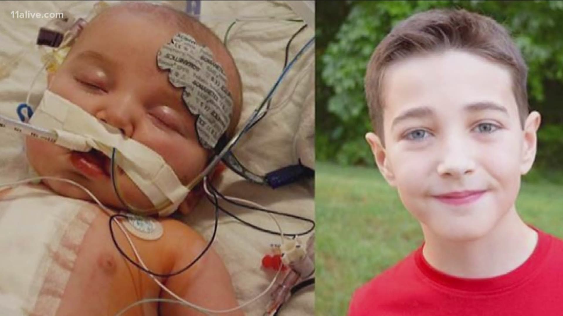 Patients with congenital heart defect share photos for awareness week ...